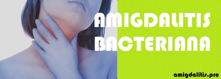 AMIGDALITIS - ANGINAS: Qué es? Causas, Síntomas y Tratamientos