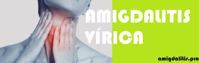 AMIGDALITIS VÍRICA: Qué es, Síntomas y Tratamiento